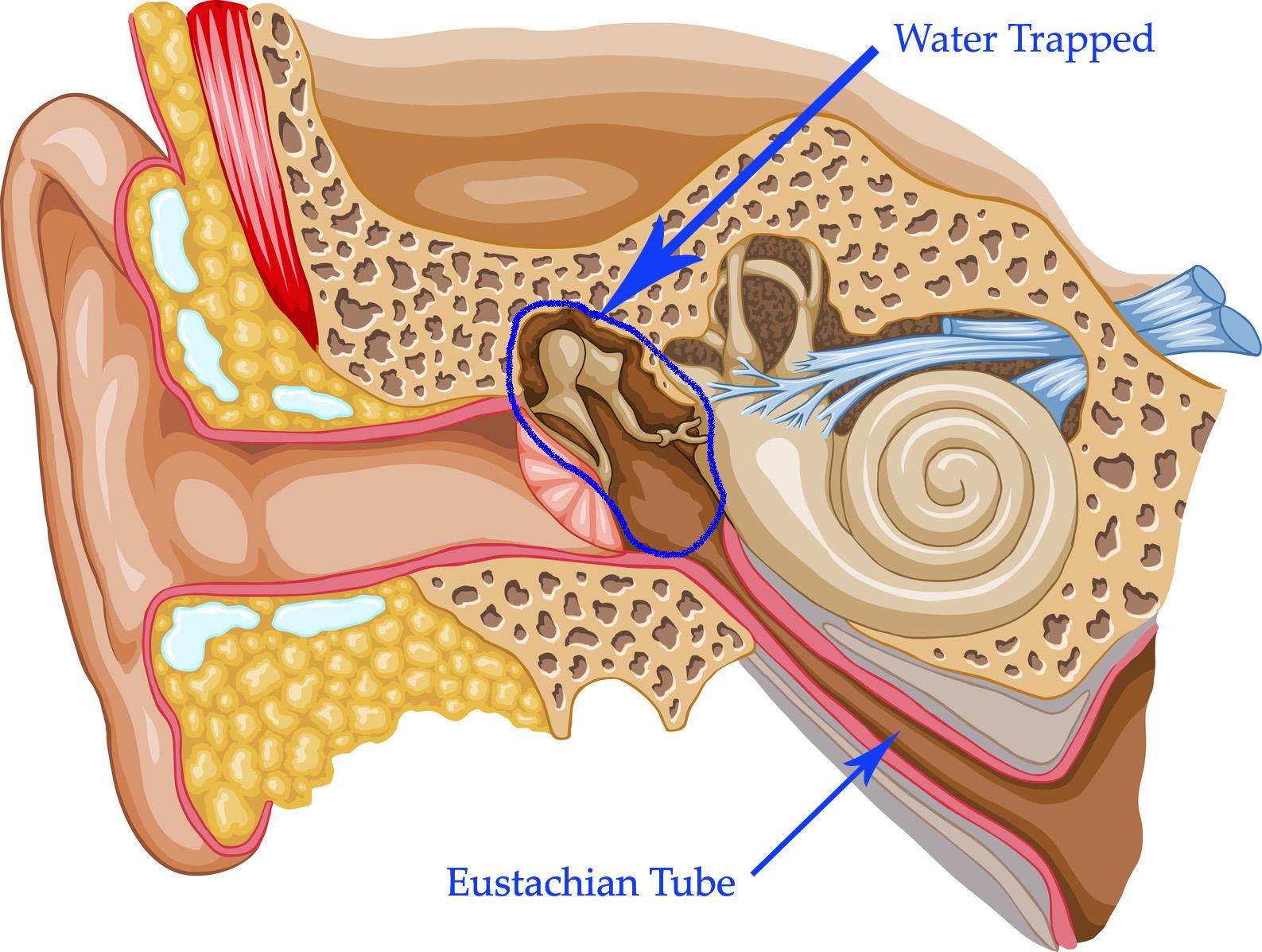 Awasi Gejala Infeksi Telinga ~ Tinnitus Indonesia