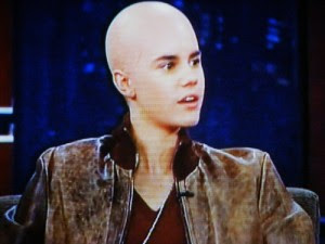 See Justin Bieber's Bald Photos