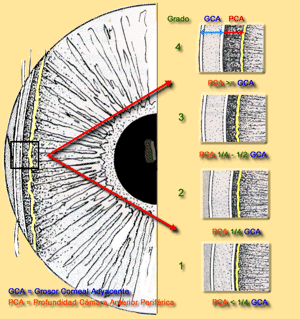 TUTORÍAS EN OPTOMETRÍA
