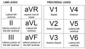 Learning how to read electrocardiograms (EKGs): Electrical system, ST ...