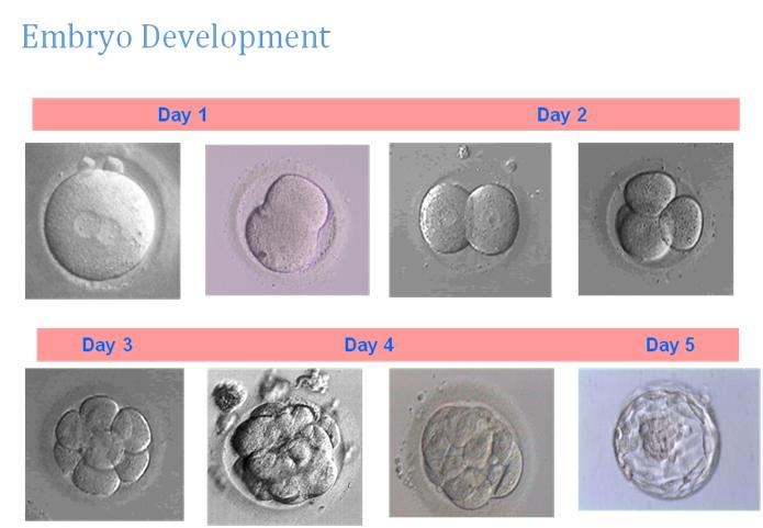 Pelvic Pain to Infertility: Egg Retrieval and Zygotes