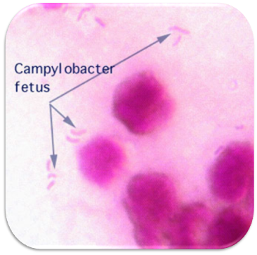 Promoción XXII Medicina Humana - UNJFSC: 2012