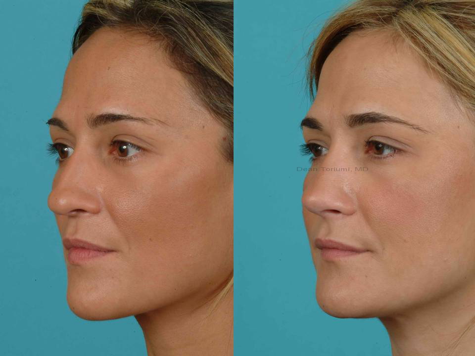 Dr. Dean Toriumi Reviews: Dean Toriumi Reviews: Patient that presents ...