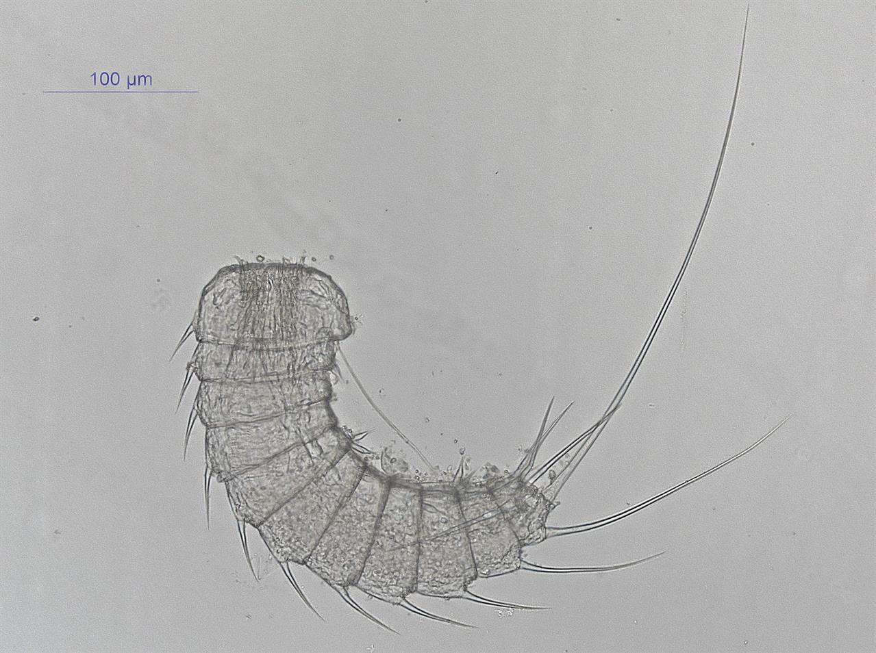 Kinorhyncha ~ Dunia Hewan