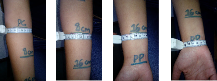 FisioEstudantes: Perimetria