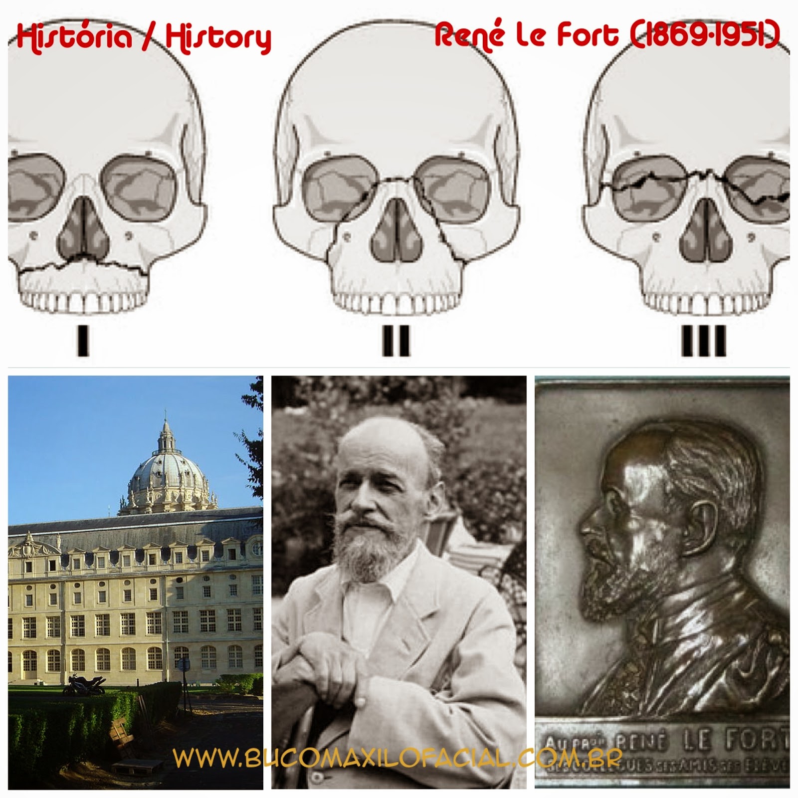 Referência em Bucomaxilofacial no Espírito Santo: História - René Le ...