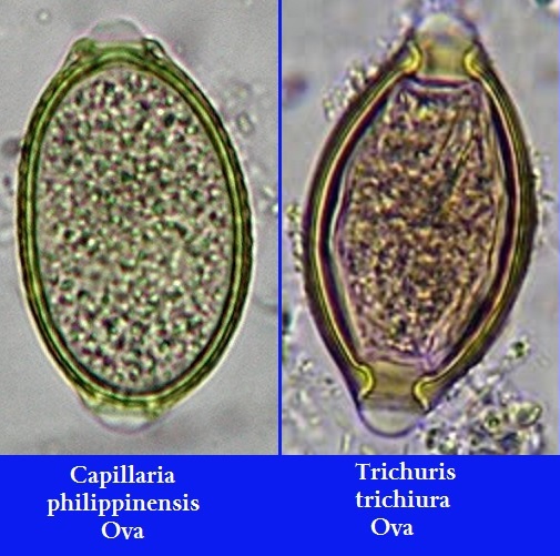 Lecture Notes in Medical Technology: Lecture #2: THE INTESTINAL NEMATODES
