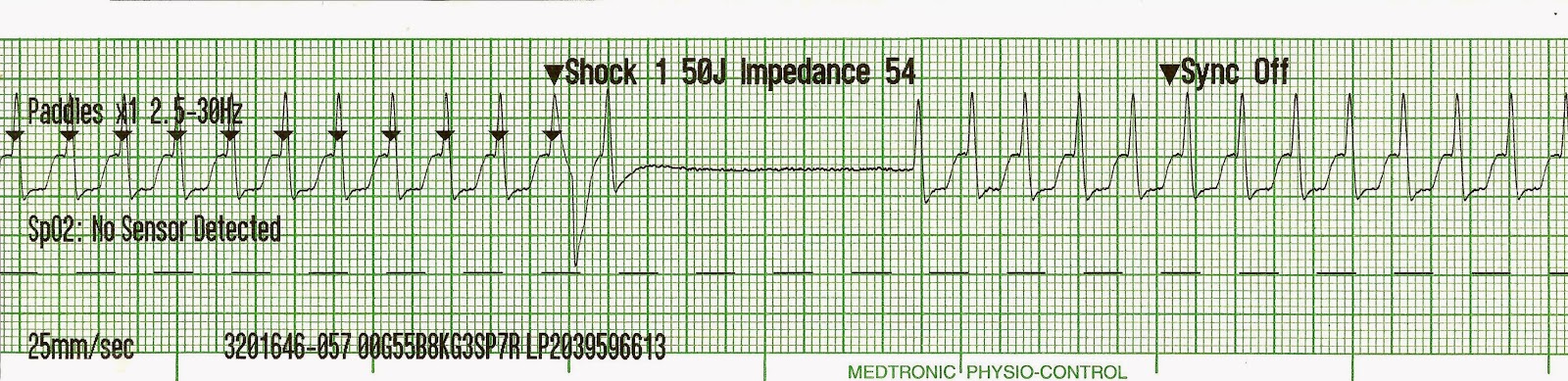Float Nurse: EKG Rhythm Quiz 264