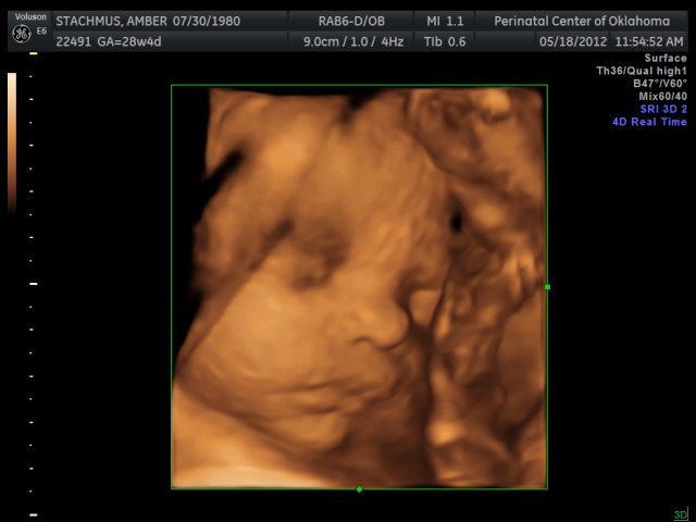 28 week Ultrasound