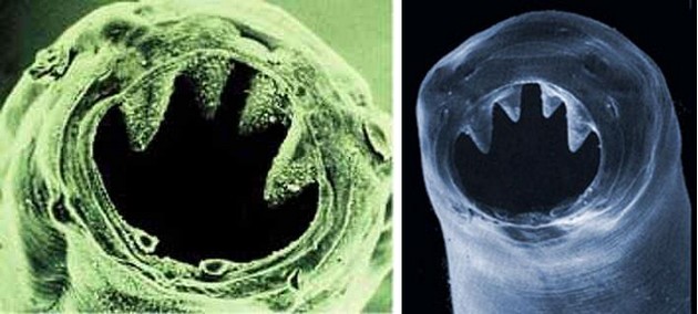 Filo nematelmintos | Biologia: A ciência da vida
