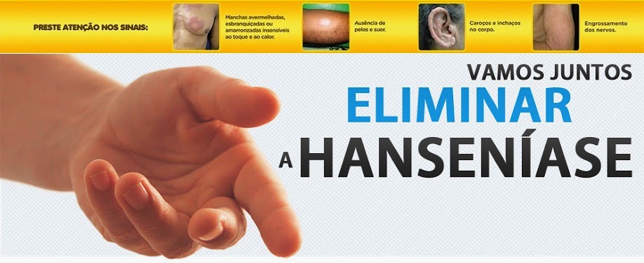 Hanseníase tem cura: Ministério da Saúde lança campanha e alerta para ...