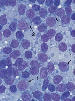 [Haematology] Cytology Atlas of Organ Biopsies and Exudates | Free ...