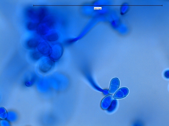 Fun With Microbiology (What's Buggin' You?): Trichothecium roseum