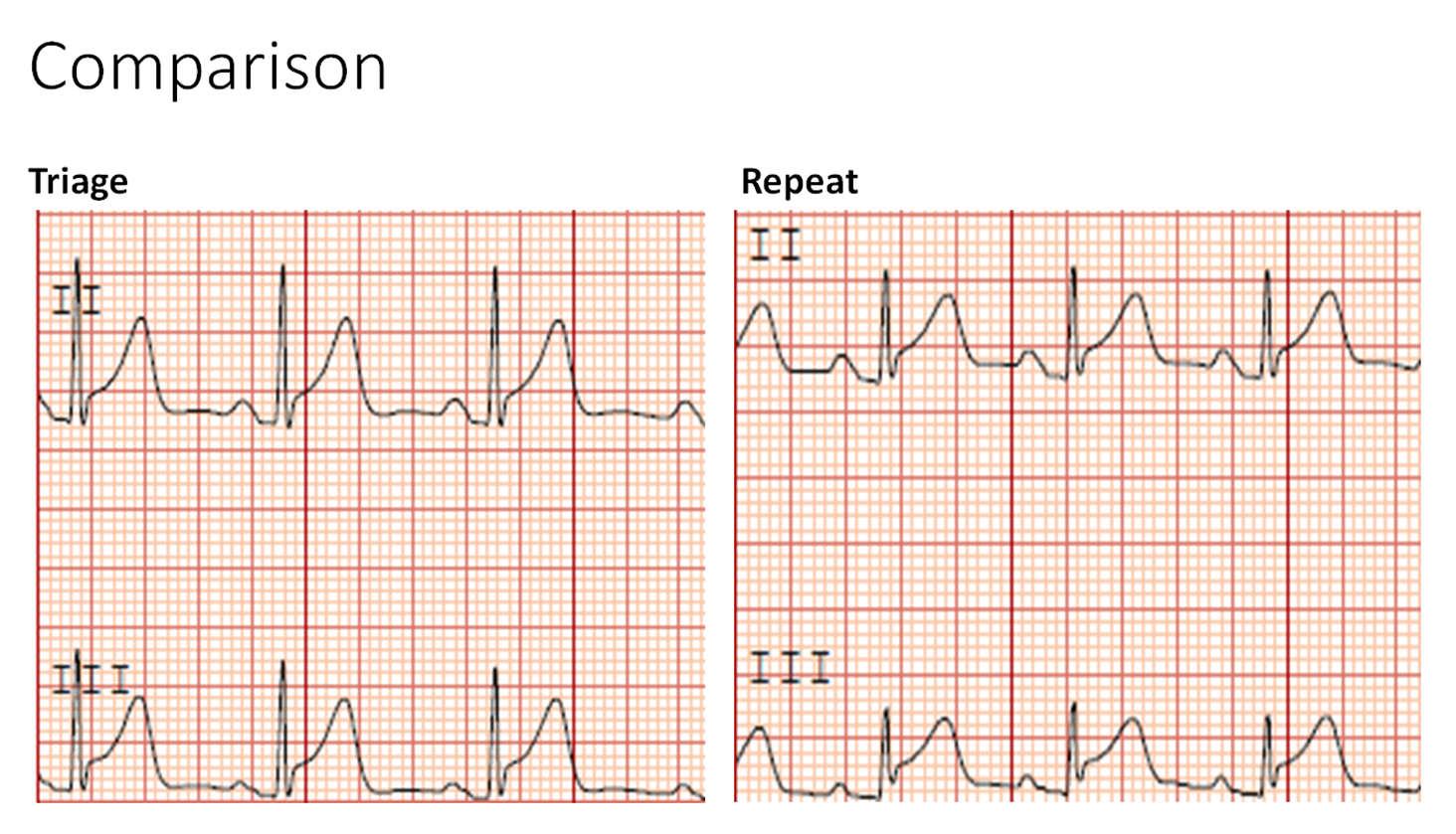 Dr. Smith's ECG Blog: July 2013