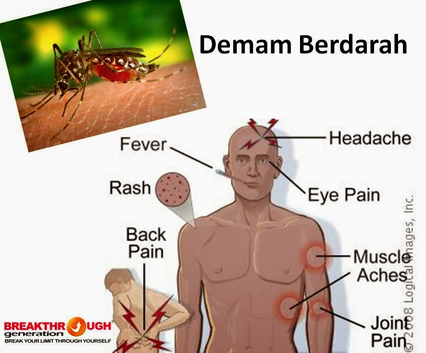 1ST STEP in UNDERSTANDING the BODY: PENYAKIT DEMAM BERDARAH (DBD)