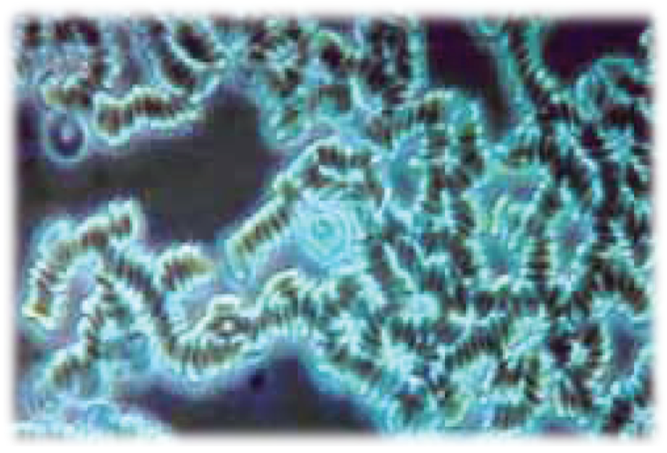 Adult Stem Cell Therapy: Microhydrin®