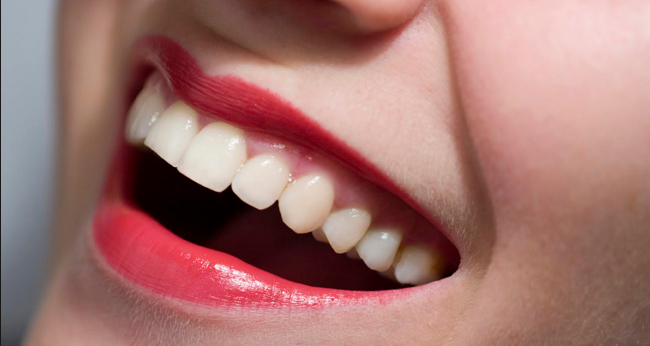 Macam-Macam Penyakit Mulut dan Cara Mengatasinya - Alif Lam Mim