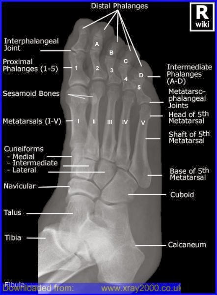 About Radiology: Teknik Radiografi Pedis