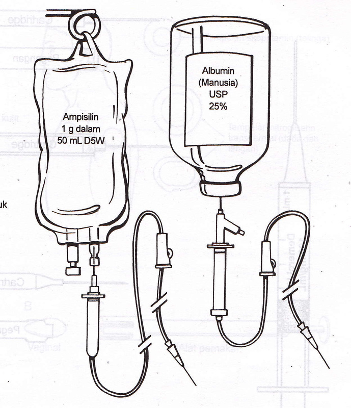 .: Prosedur Pemasangan Infus Intravena (Intravenous Fluids Infusion)