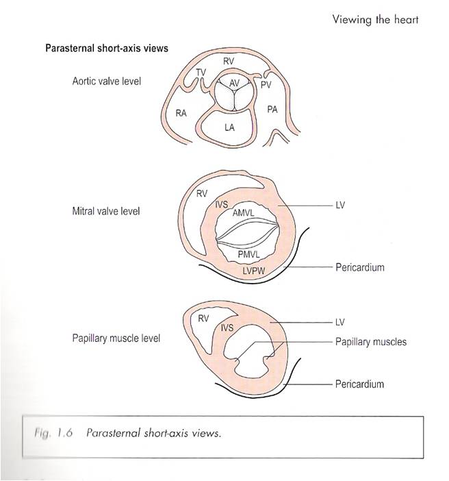 CVT Mohd Farid: Recommended Echocardiography Protocol For Routine ...