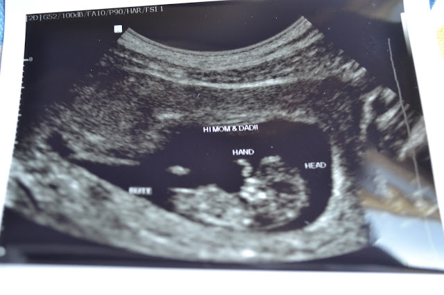 The Baker Bustle: Guess Whaaaaaaaaat!!!