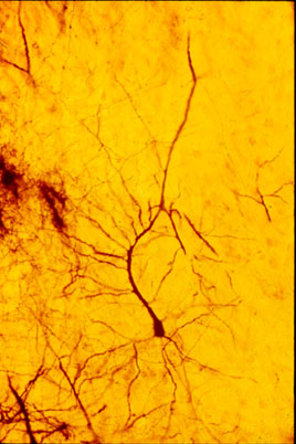 The Cellular Scale: Seeing Cells: Nissl and Golgi together at last