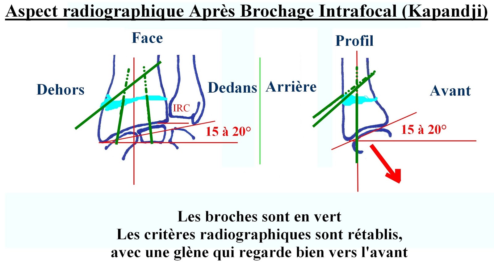5 Les Possibilits D39opposition Du Pouce Kapandji 1986
