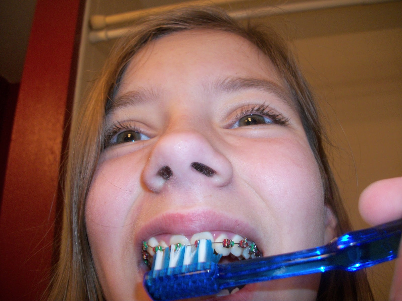 Life Through Ellie's Eyes: Braces