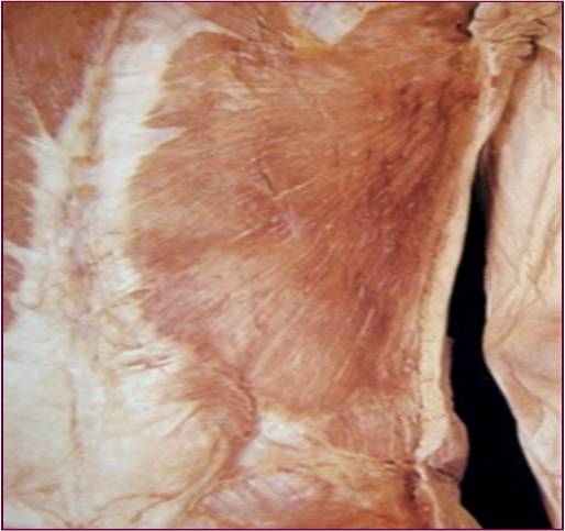 Anatomia Humana Con Marilyn Barrios: MIEMBRO SUPERIOR