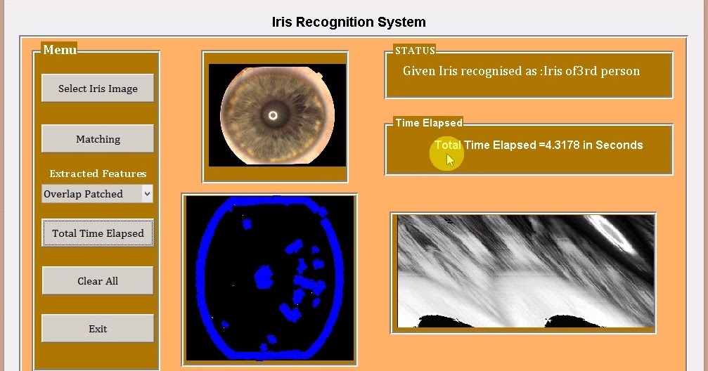 Matlab Project Iris Recognition System Using Discrete Cosine Transform