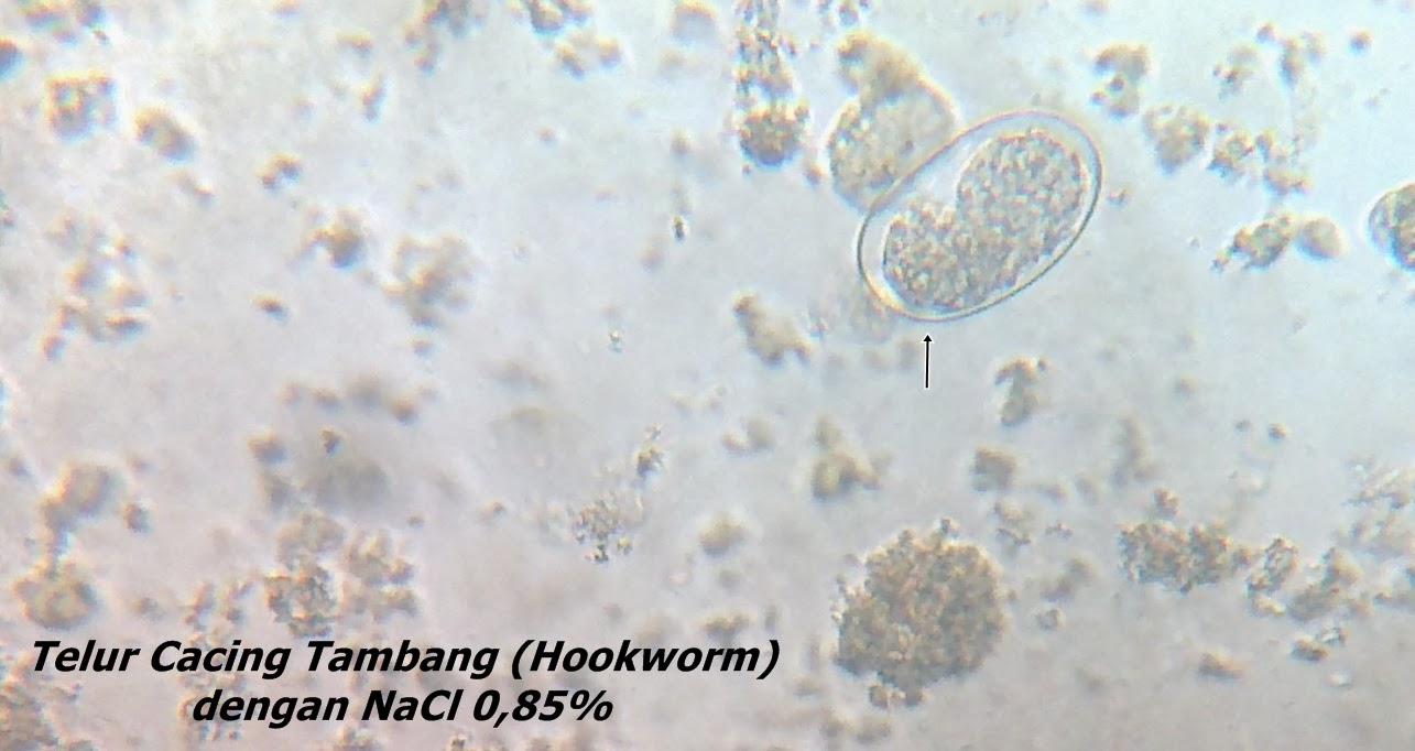 Rizqi Murtafi'ah: Pemeriksaan Telur Cacing Dengan Metode Teknik NaCl Jenuh
