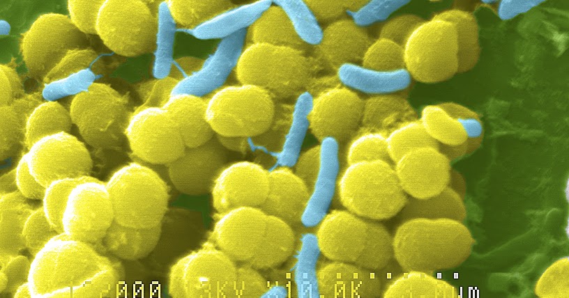 Microbiología para todos: ¿Sabes qué es un microbio?