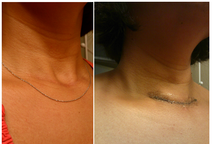 How does my neck look?: May 2011