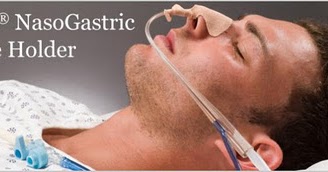 Memasang Nasogastric Tube (NGT)