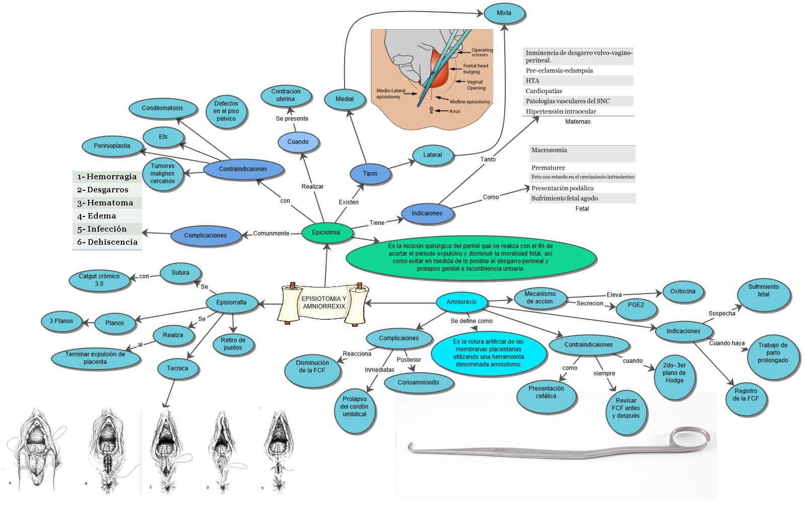 Ginecología y Obstetricia: Amniorrexis y episiotomía