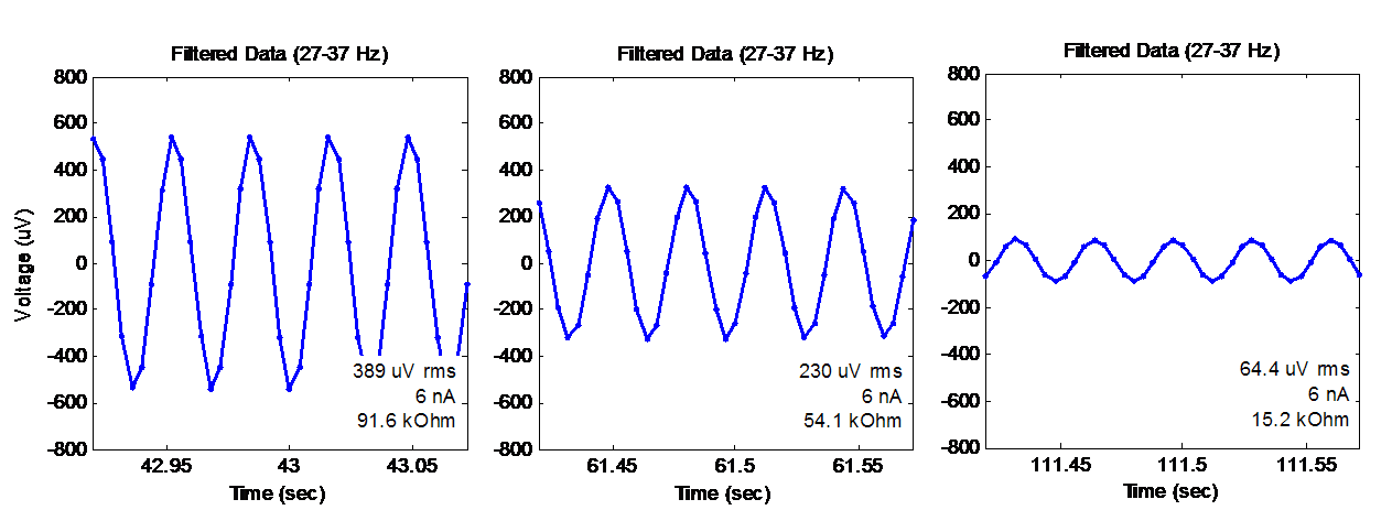 EEG Hacker: Impedance of Electrodes on my Head
