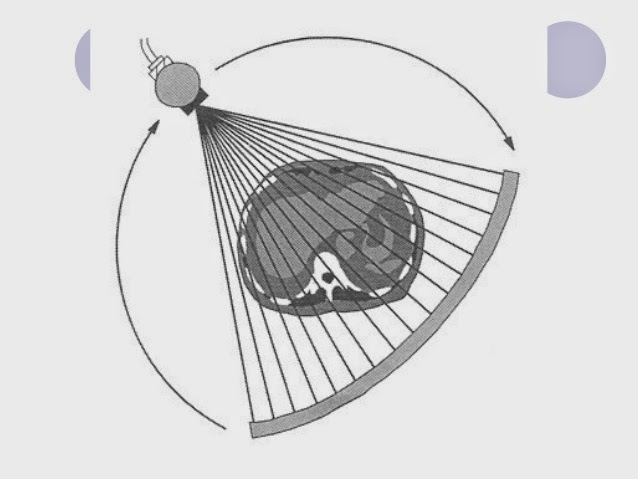 CROSS-SECTIONAL IMAGING EDUCATION HUB: GENERATIONS OF CT SCANNERS