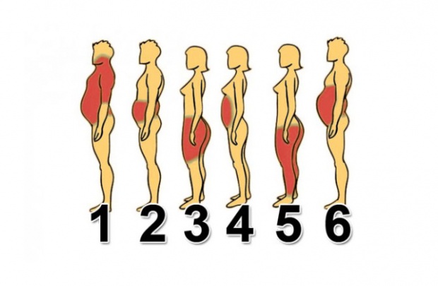 Saznajte u koji tip gojaznosti spadate, i kako da taj problem rešite!