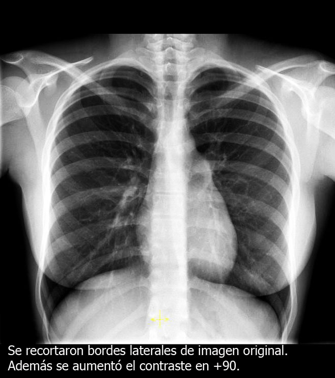 Yo aprendo de rayos X: Imagenología