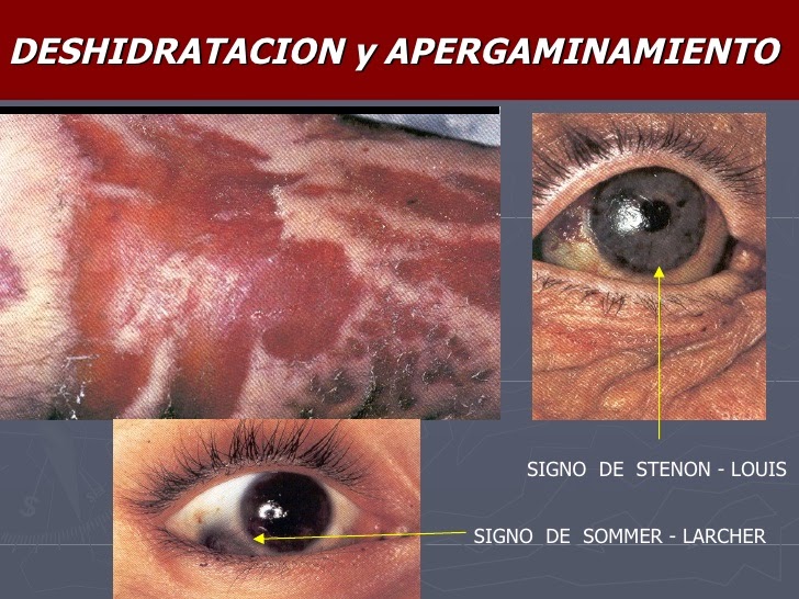 STRICTI IURIS: SUCESOS Y REACCIONES DEL CUERPO HUMANO AL MORIR.