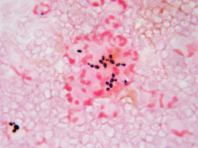 Fun With Microbiology (What's Buggin' You?): Alternative Stains ...