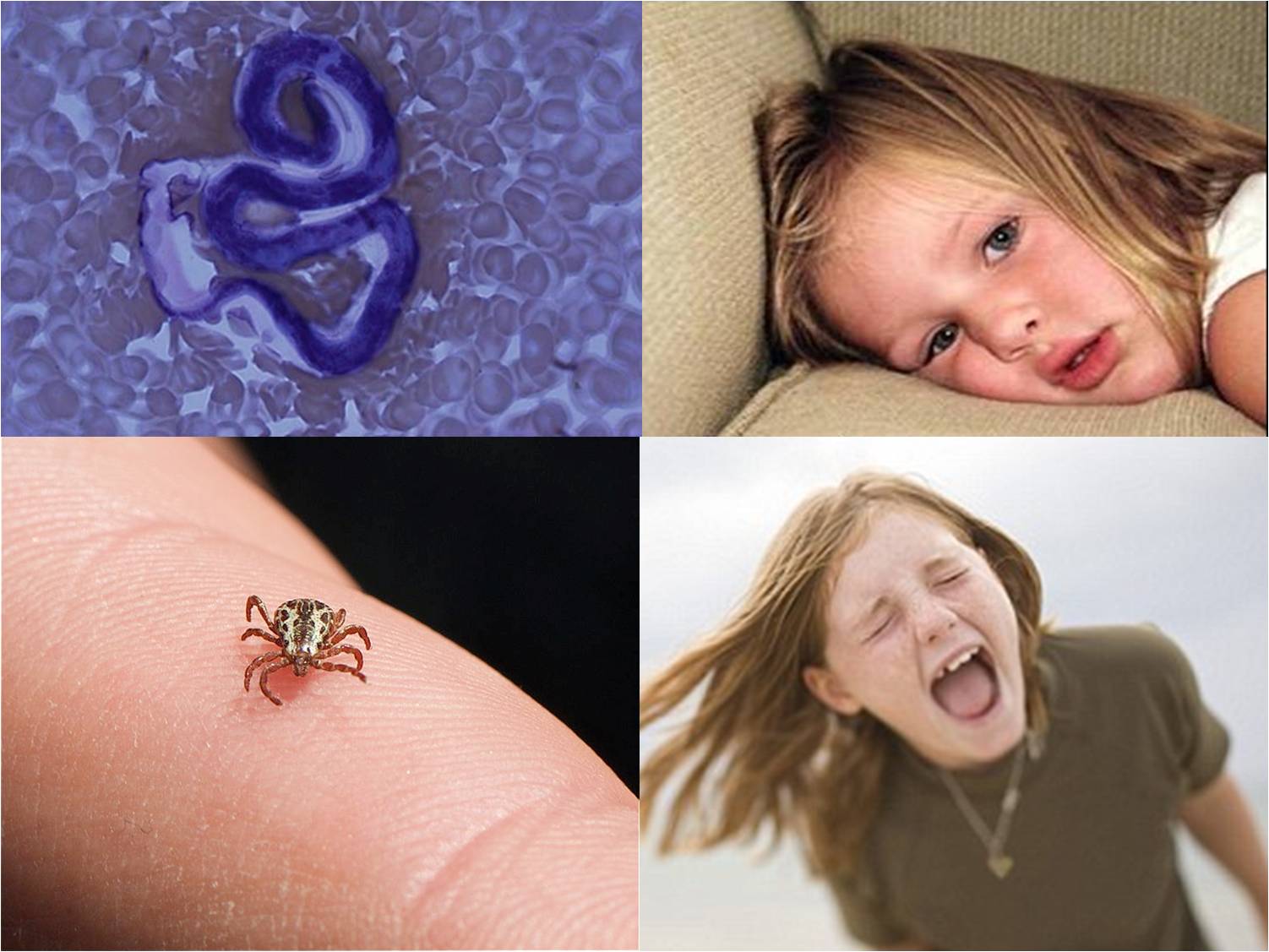 TDAH Crianças que Desafiam: TDAH e alucinações - Psicose e Mania ...