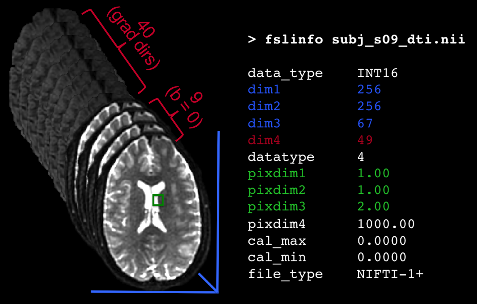 DTI Tutorial 1 - From Scanner to Tensor | Diffusion Imaging ...