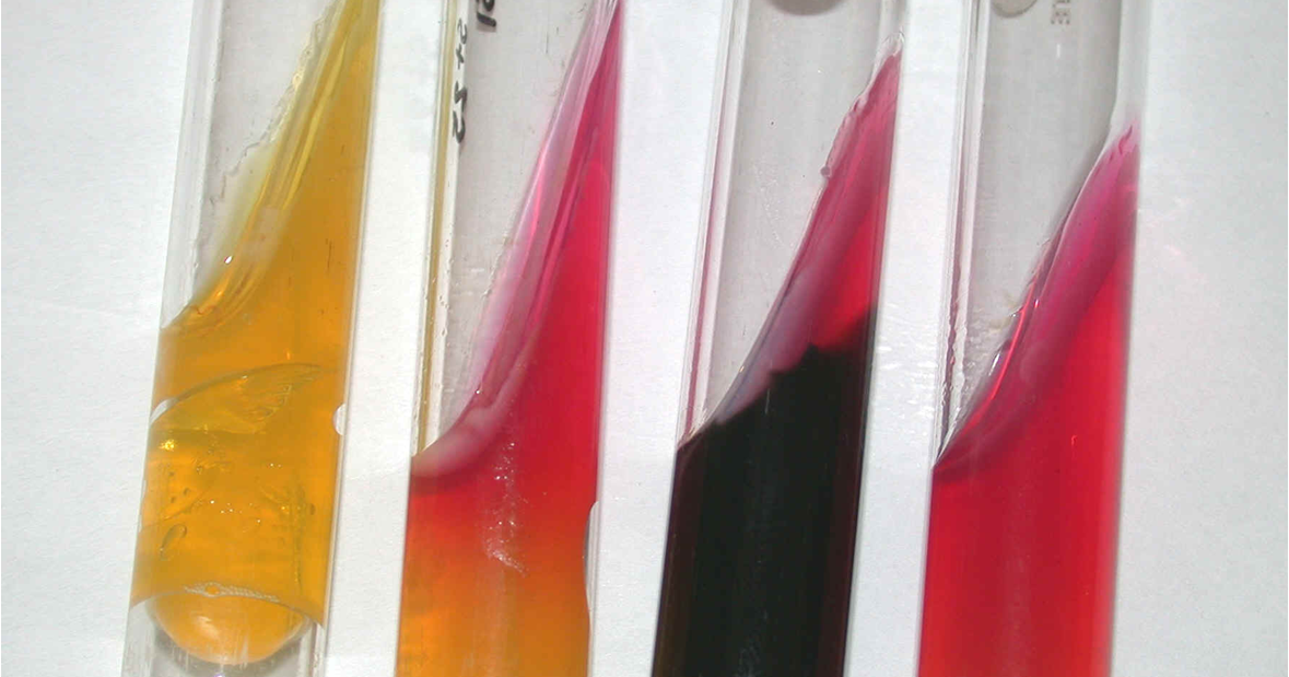 Medical blogs: principle of biochemcial test of gram negative bacteria ...