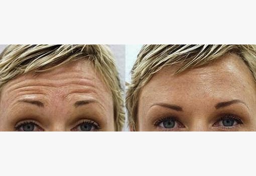 Inverness Dermatology & Laser