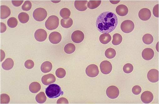 hematología una ciencia