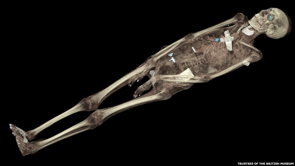 Ancient Mummies Gallery - CT scans of mummies