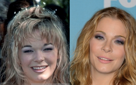 LeAnn Rimes Plastic Surgery