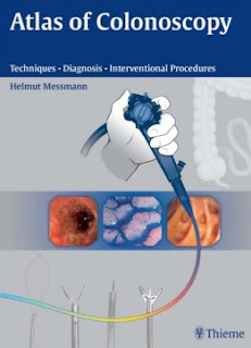 Atlas of Colonoscopy: Techniques - Diagnosis - Interventional ...