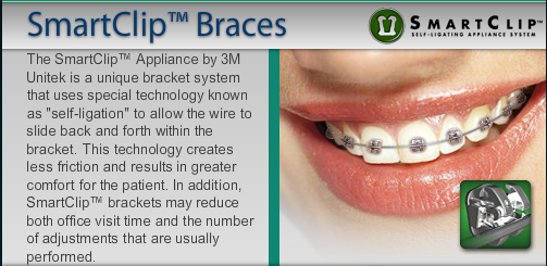Morristown Orthodontics : SmartClip Braces